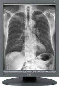 Diagnostic display - MS35i2 - TOTOKU - mammography / LCD / LED-backlit