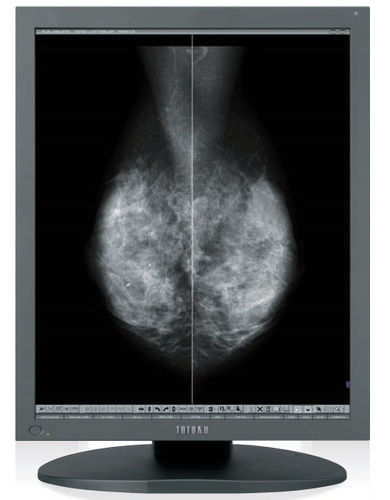 Mammography display - MS55i2 - TOTOKU - high-definition / LCD / LED-backlit