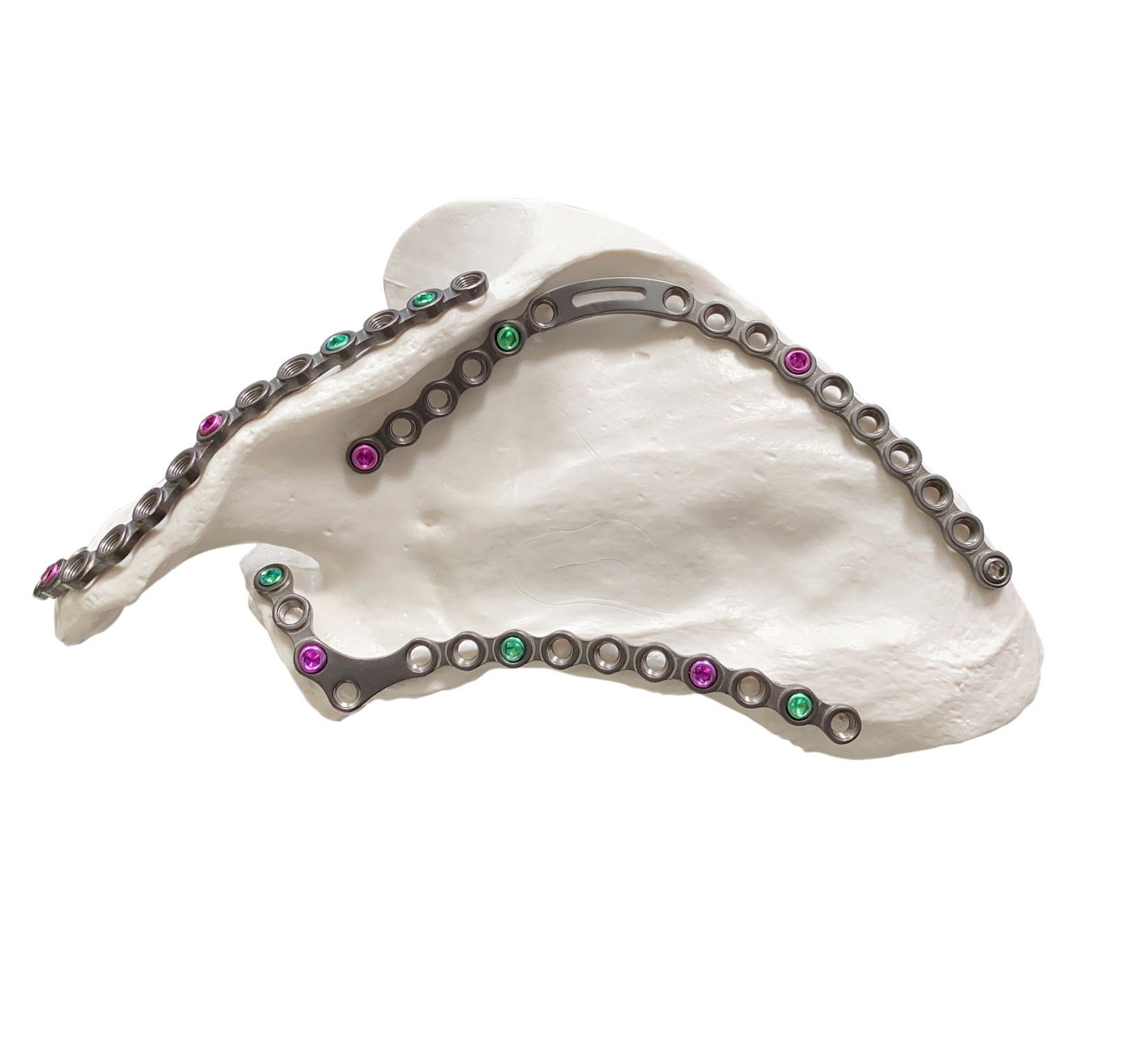 Scapula compression plate - HJ-Scapula - Health-Joy Medical - lateral ...