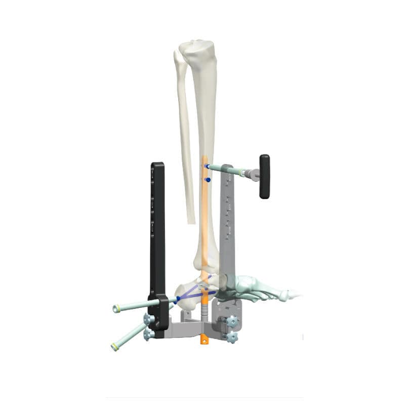 Ankle arthrodesis nail - BLK - Health-Joy Medical - pediatric