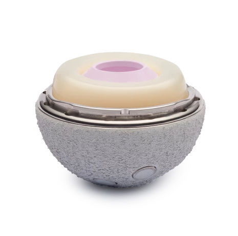 Cementless acetabular prosthesis - Trinity™ Dual - Corin