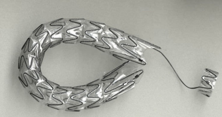 Ureteral stent - URS - Allium Medical Solutions - self-expanding