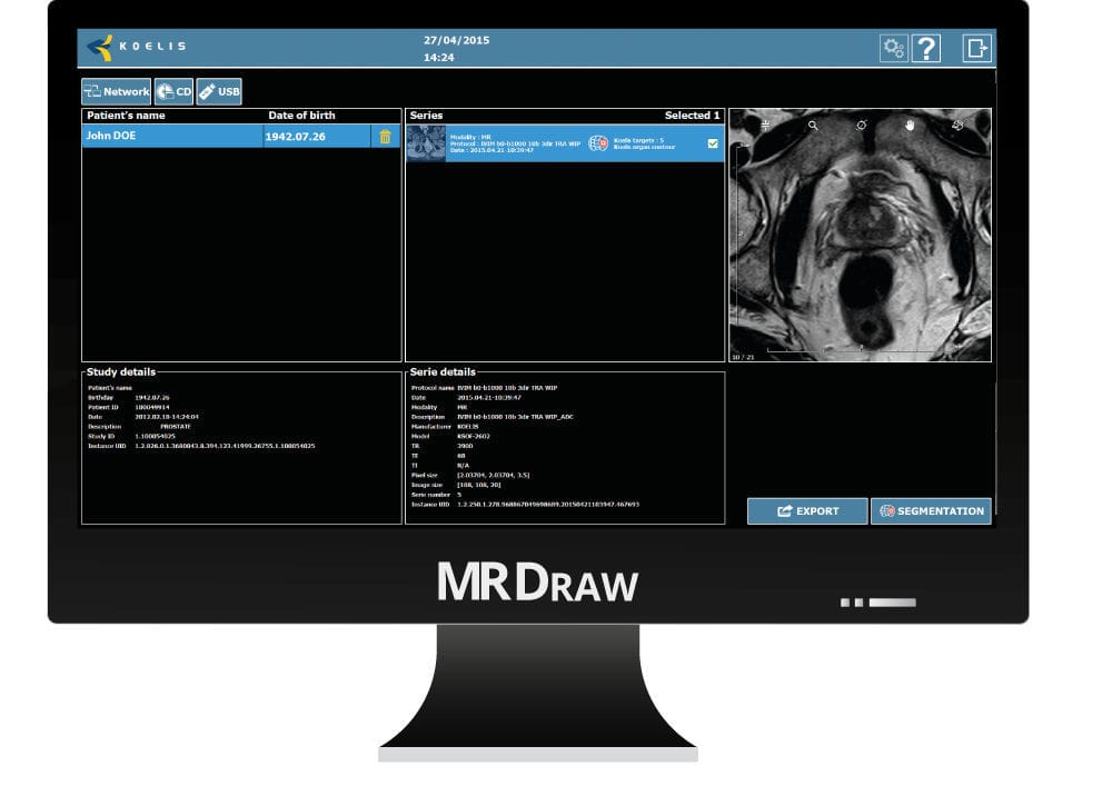 MRI computer workstation / for ultrasound imaging - Mr-Draw® - KOELIS