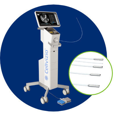 CLE endoscopic imaging system - CELLVIZIO® - Mauna Kea Technologies ...