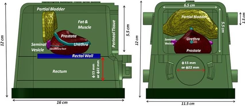 Ultrasound imaging test phantom / bladder / prostate - S-B-2.3 - Yezitronix