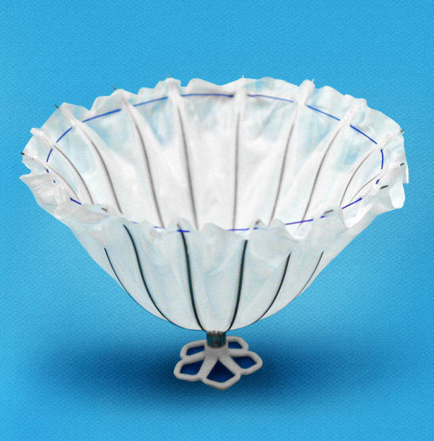 Left ventricle cardiac restoration system - Parachute® - Cardiokinetix