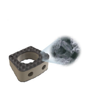 Cervical interbody fusion cage - ShurFit® ACIF 2C - Precision Spine ...