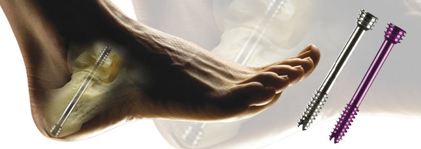 Forefoot compression bone screw / headless - CHARLOTTE® 7.0 - Wright ...