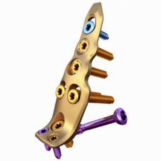 Fibula compression plate - ORTHOLOC™ - Wright Medical Technology ...