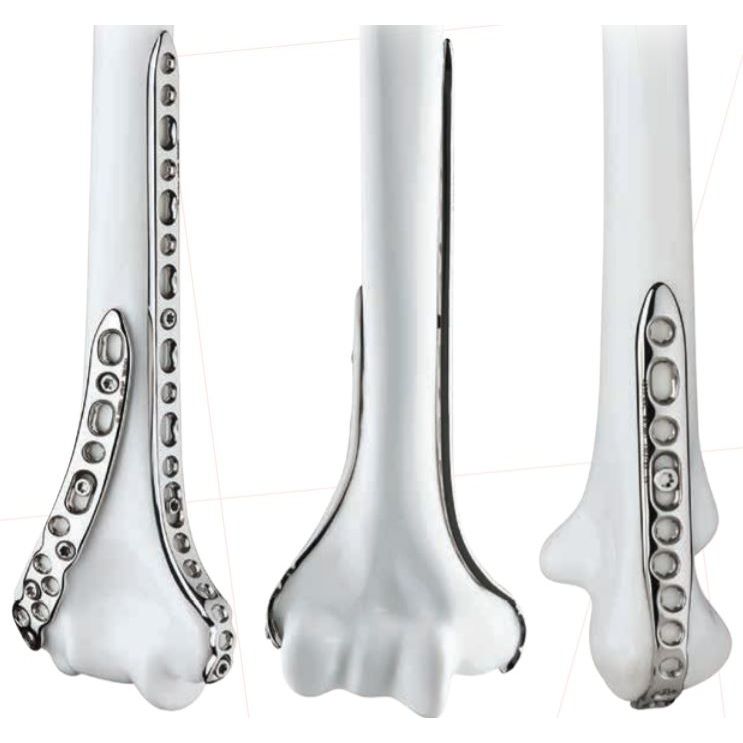 Radial head compression plate - EVOLVE™ EPS - Wright Medical Technology ...