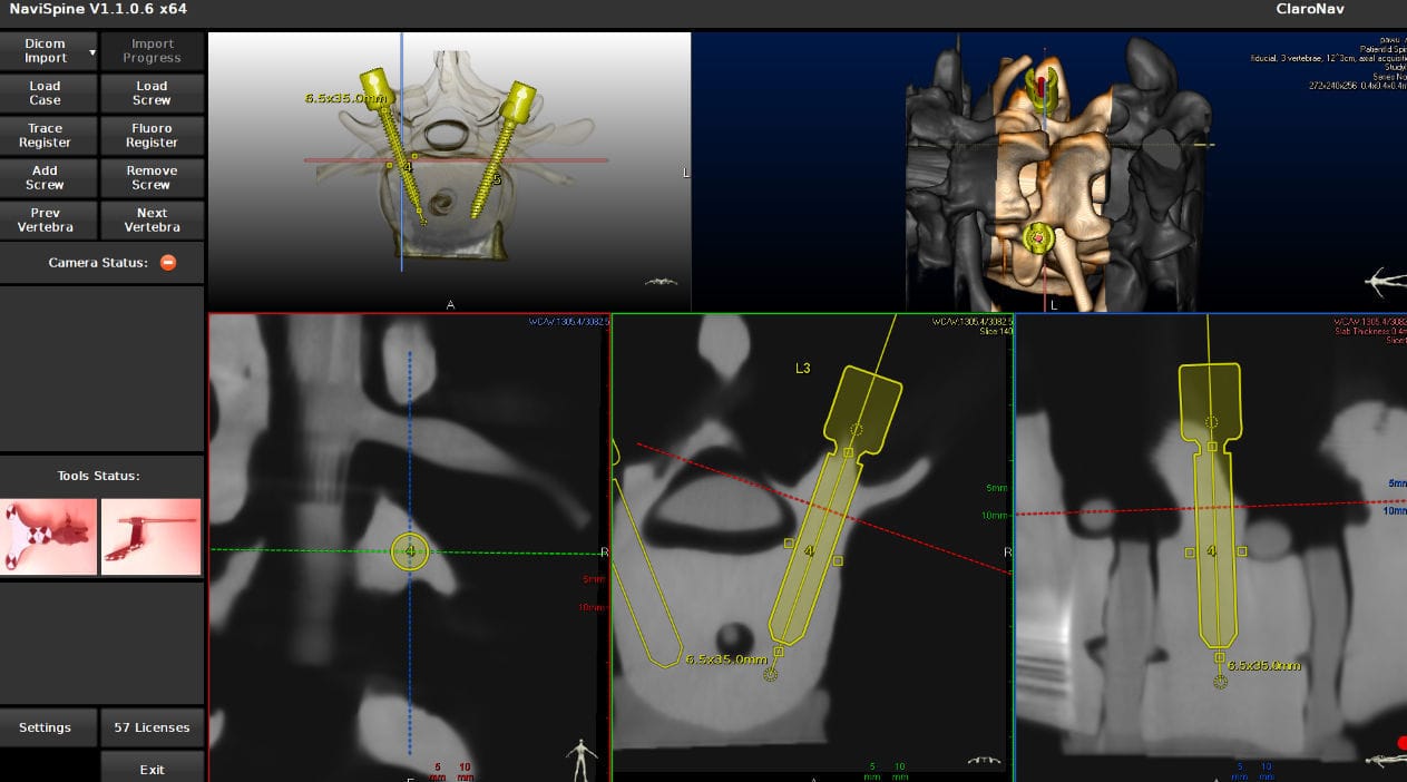 Surgical navigation software - NAVIX - Claron Technology - for robotic ...
