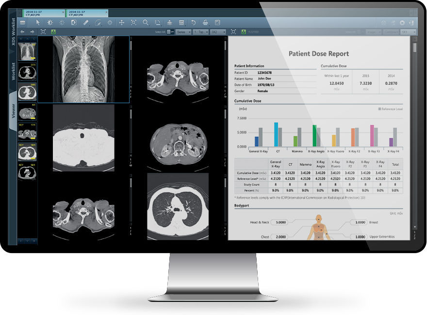 Visualization software - INFINITT North America - viewer / medical ...