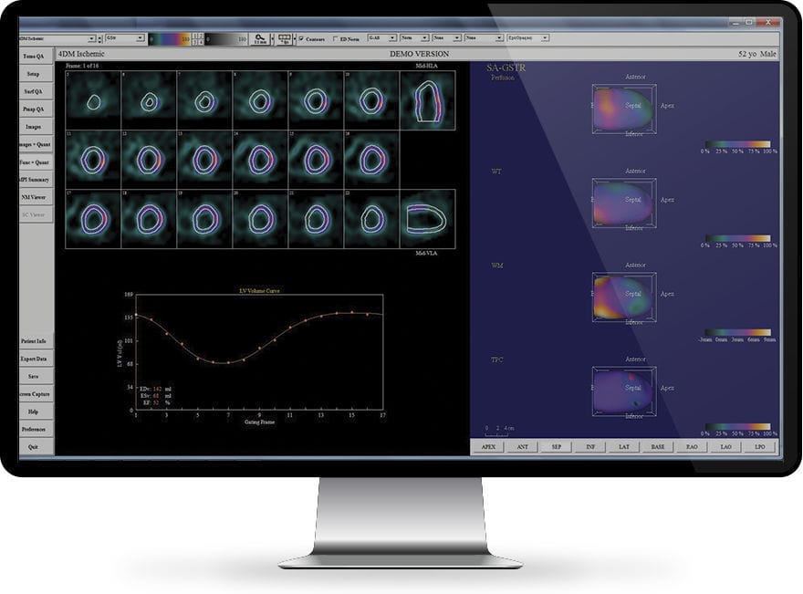 Reporting software - INFINITT North America - viewer / post-processing ...