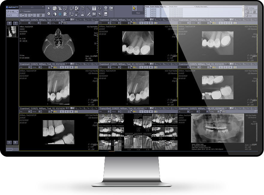 Medical imaging PACS - Dental - INFINITT North America - web-based