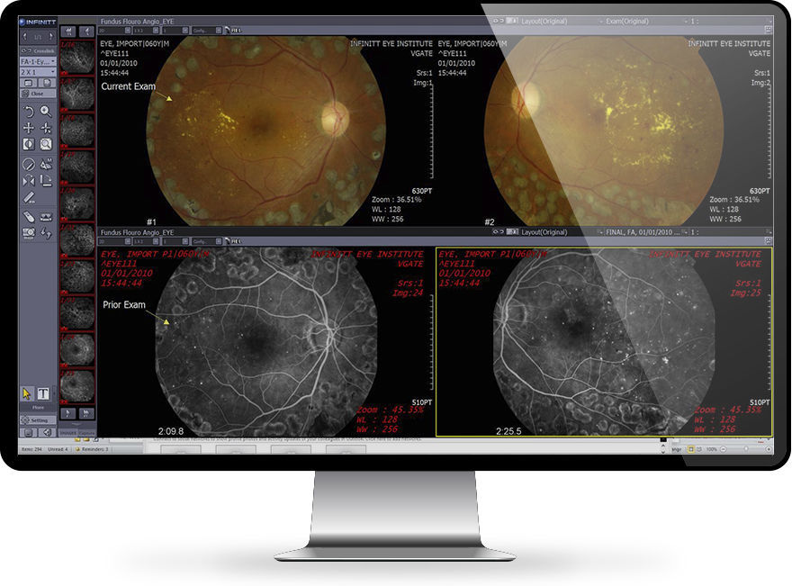 Medical imaging PACS - Ophthalmology - INFINITT North America - web-based