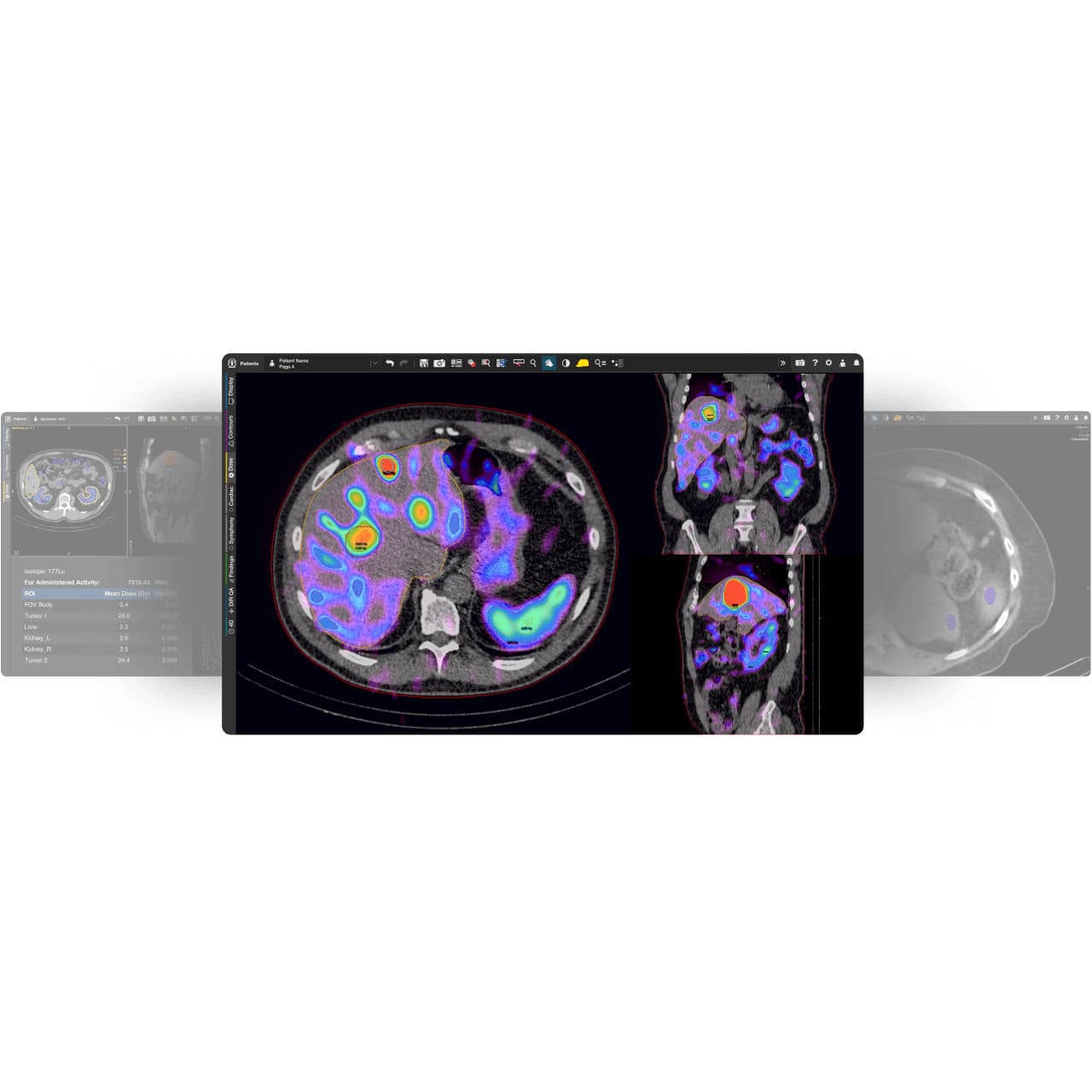 Reporting software - MIM SurePlan™ MRT - MIM Software - radiation dose ...