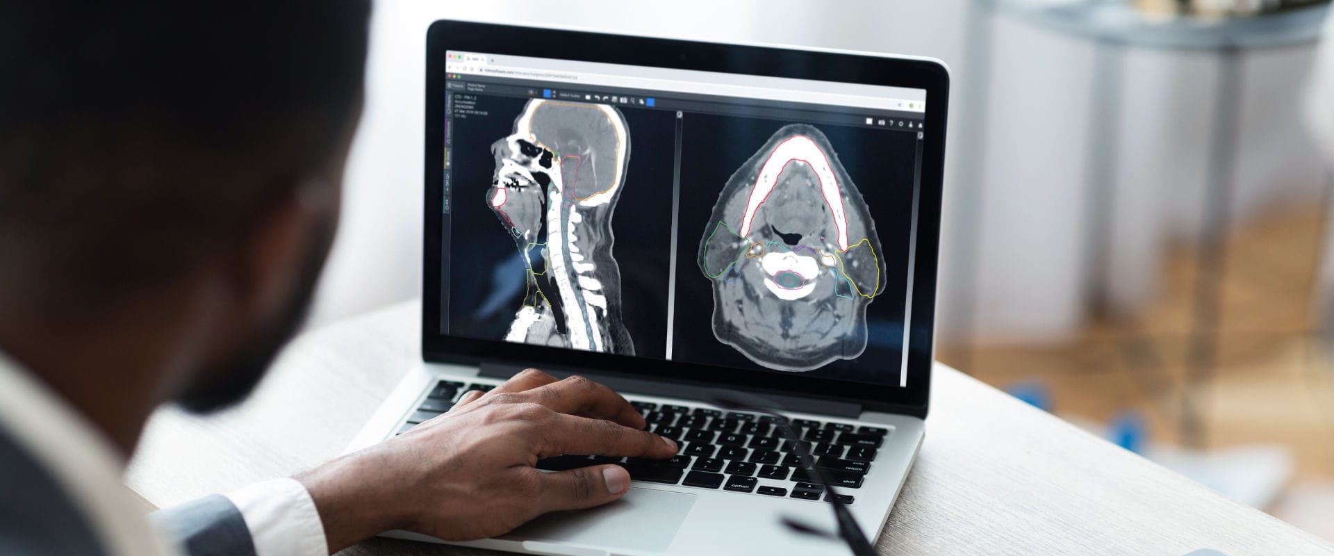 Access control software - MIM Zero Footprint™ - MIM Software - clinical ...