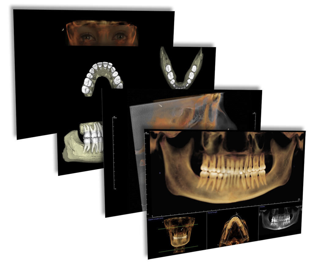 Anatomage Dental ANATOMAGE TABLE CLINICAL Portable Virtual