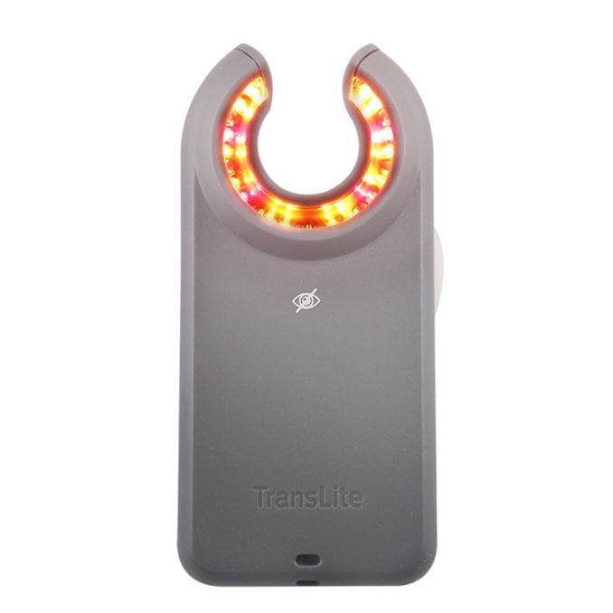 LED vein finder - EMS PRO® - Veinlite - white light / venipuncture ...