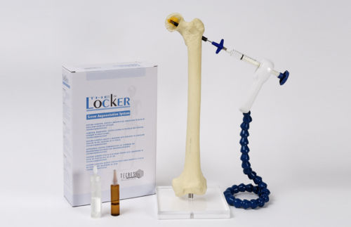 Bone cement injection instrument kit - Locker - Tecres - single-use
