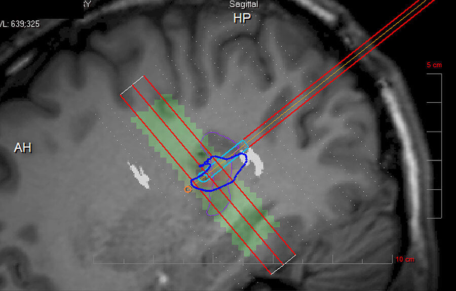 Planning software / acquisition / contouring / medical imaging ...