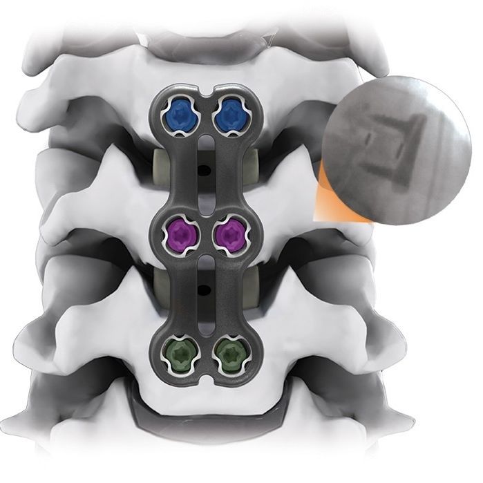 Cervical vertebra arthrodesis plate - IRIS® - Life Spine - locking / 2 ...