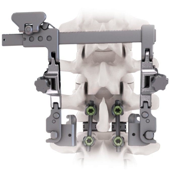 Orthopedic surgery retractor - CALYPSO™ - Life Spine