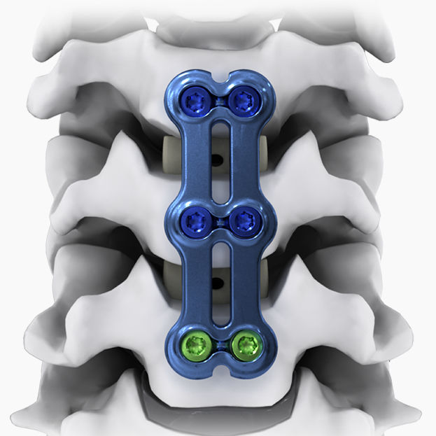 Cervical arthrodesis plate - NEO®-SL - Life Spine - locking / metallic ...