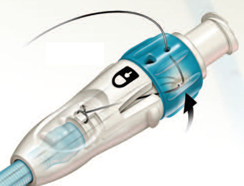 Urine drainage catheter - Exodus® - Navilyst Medical - biliary