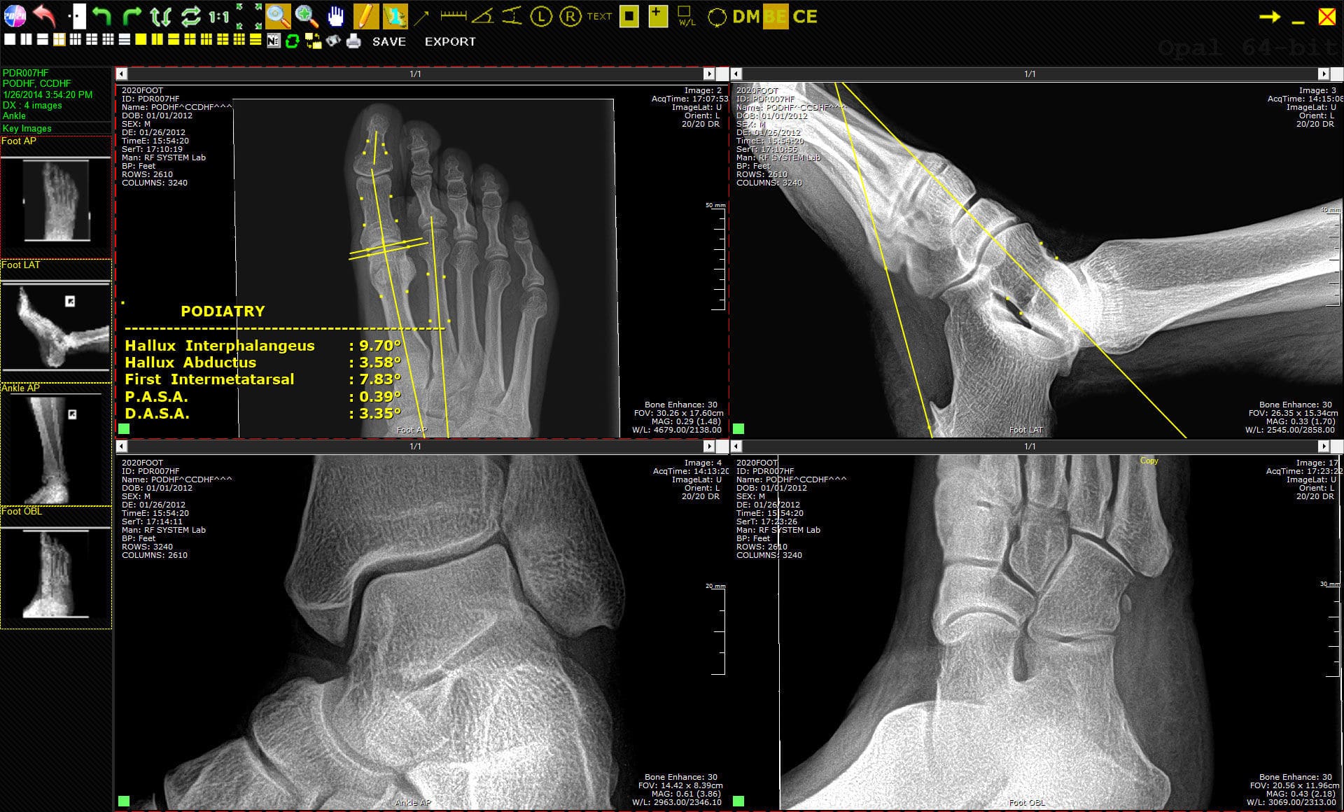 Medical imaging transmission system - Opal-RAD - 20/20 Imaging - for ...