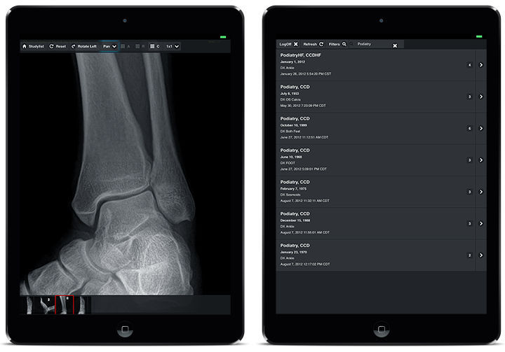 IOS visualization application - mOpal - 20/20 Imaging - medical imaging ...