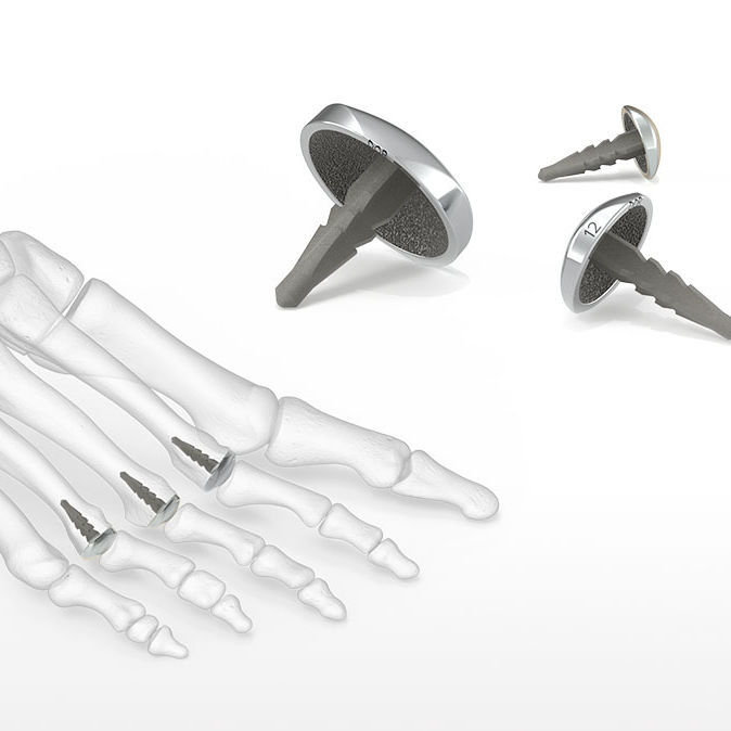 Metatarsophalangeal joint implant - EnCompass™ - Acumed