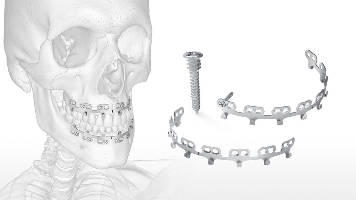 Mandibular distractor - QuickFix™ MMF - Acumed - external / adult