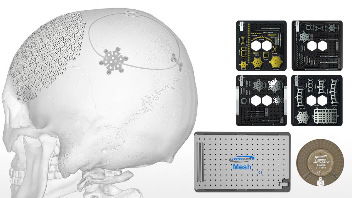 Non-absorbable cranial fixation system - Fast Flap™ - Acumed