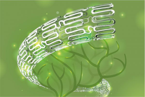 Intracranial stent - NOVA™ - SINOMED - drug eluting