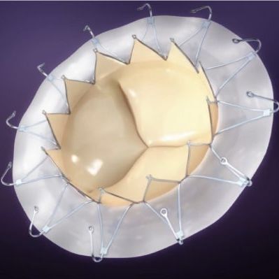 Mitral valve bioprosthesis - AccuFit® - SINOMED