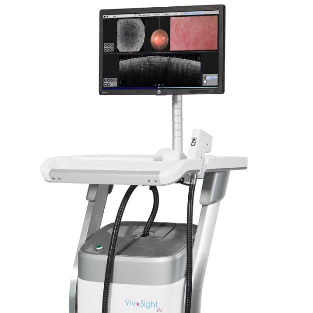 Skin layer OCT skin analysis system - VivoSight - Michelson Diagnostics