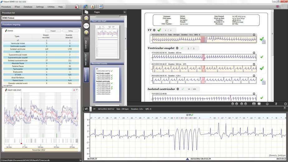 Reporting software - RTSoft Ultima - Novacor - security / clinical