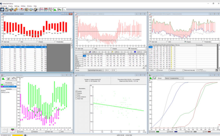 Analysis software - HolterSoft Ultima ABPM - Novacor - management ...