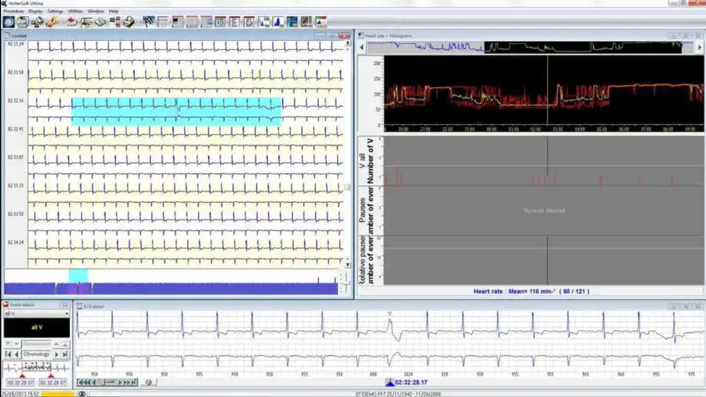 Analysis software - HolterSoft Ultima - Novacor - reporting / clinical