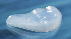 Submalar implant - Binder Submalar® II - Implantech - anatomical / silicone