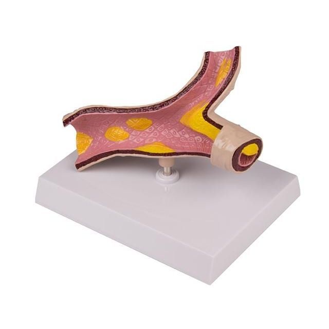Artery model - YA/C017 - Yuan Technology - for teaching