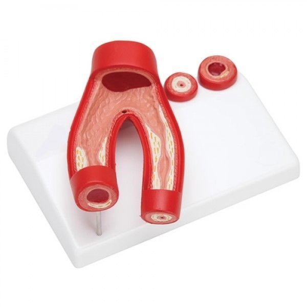 Artery model - ZKJ-680-A - Educational + Scientific Products Ltd