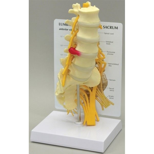 Lumbar model - GBM-036 - Educational + Scientific Products Ltd - nerve ...