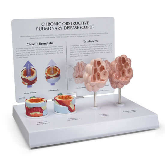 Bronchus anatomical model - 3130 - GPI Anatomicals - for teaching / COPD