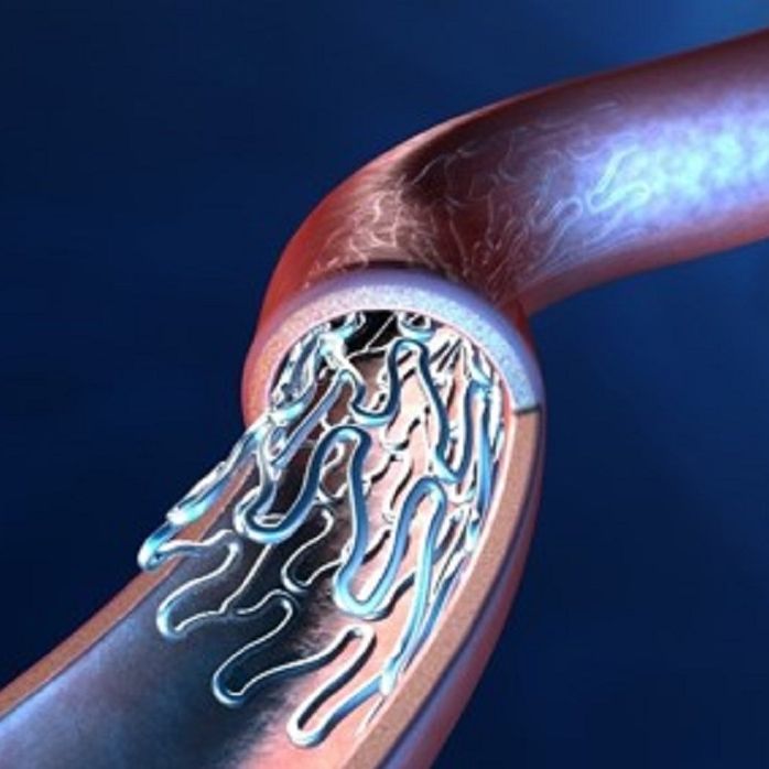 Coronary stent - CCFlex - eucatech - cobalt-chromium / bare