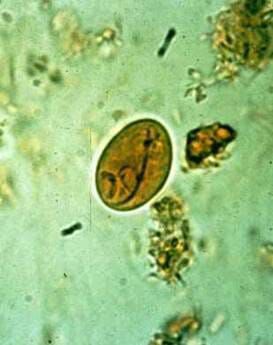 Fixative solution reagent - APAFIX - Apacor Ltd. - preservative / for ...