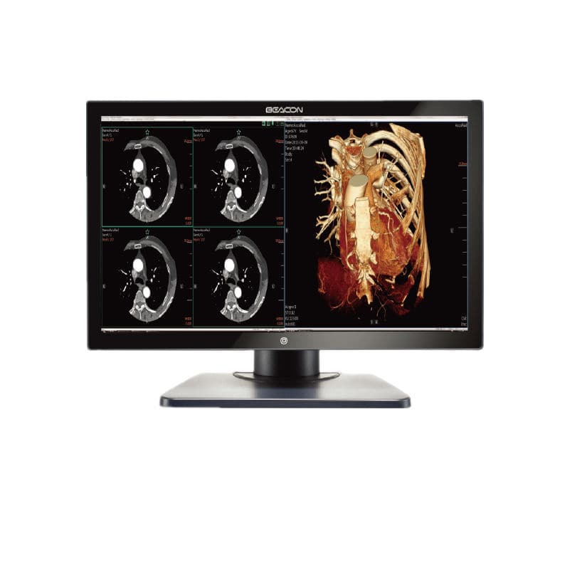 Diagnostic display - C61W+ - Shenzhen Beacon Display Technology - high ...