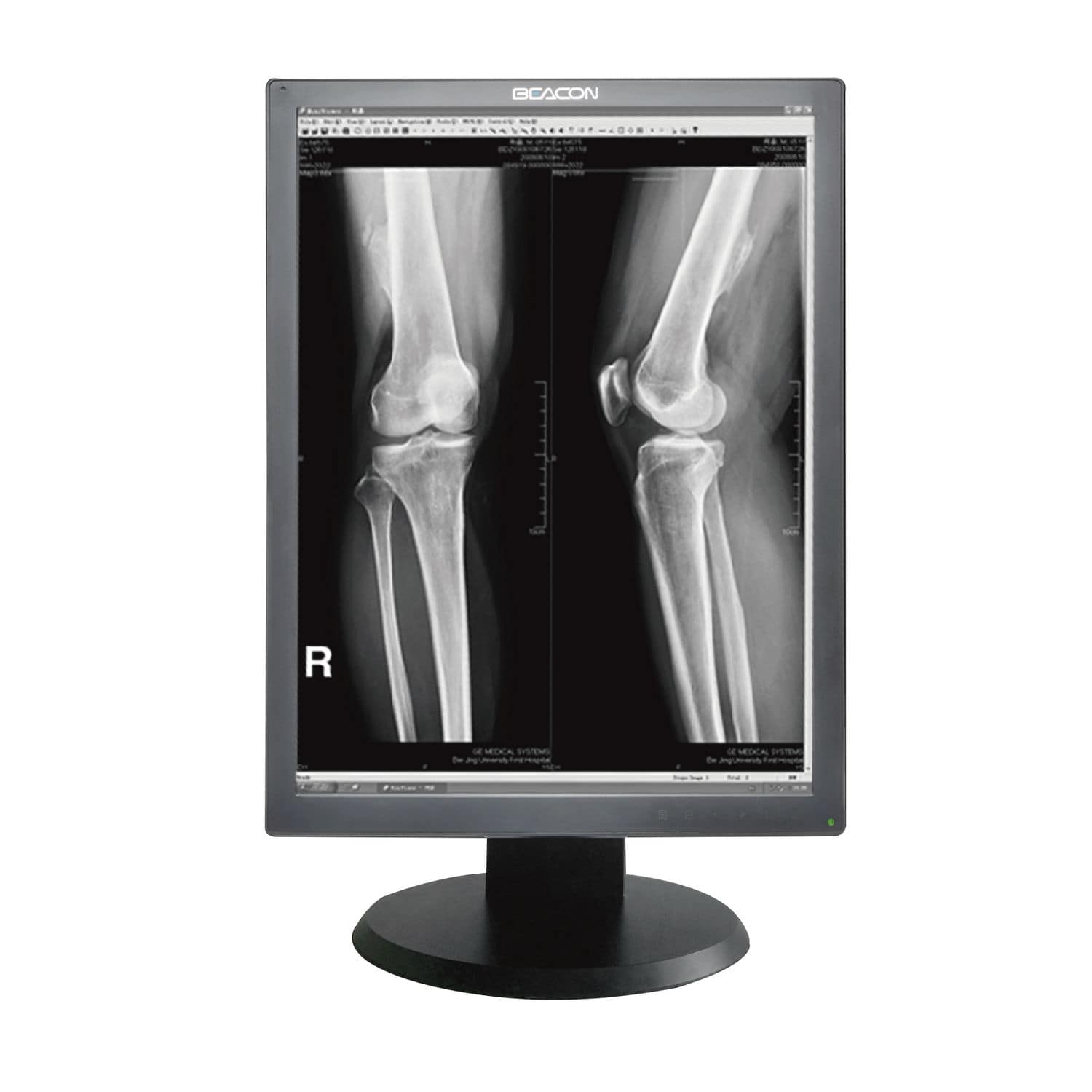 Diagnostic display - G23S+ - Shenzhen Beacon Display Technology - high ...