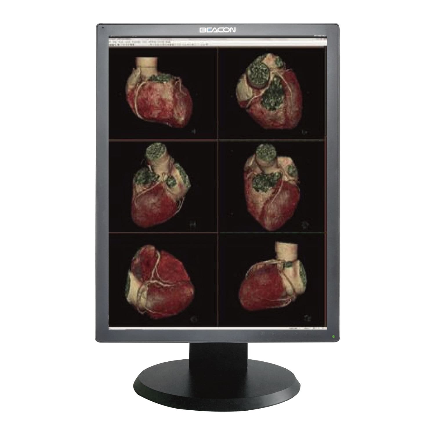 Medical imaging display - C310S - Shenzhen Beacon Display Technology ...